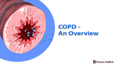 Films Media Group - COPD: An Overview (Animated Atlas of COPD)