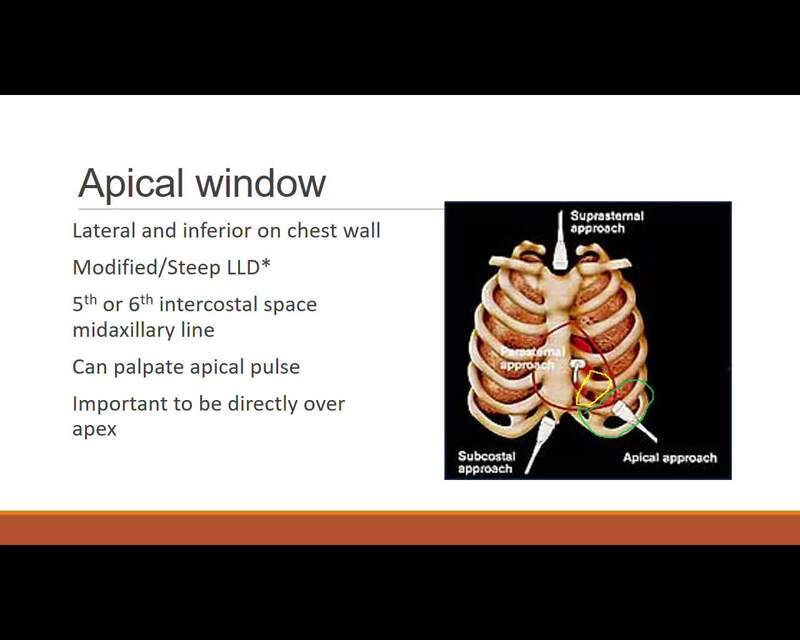 MRSC 10094 - 2nd half of lecture 3 - Apical views