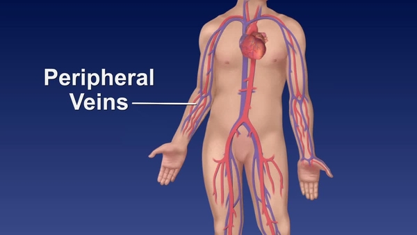 picc line insertion for chemo