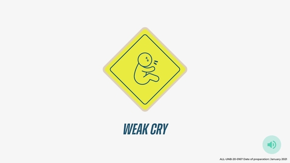 SMA 1_Weak Cry_Caregiver and HCP