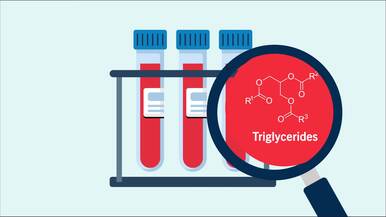 triglycerides levels normal