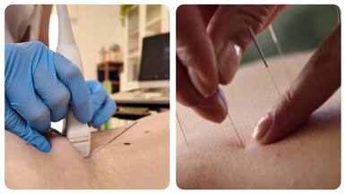 moving needle technique