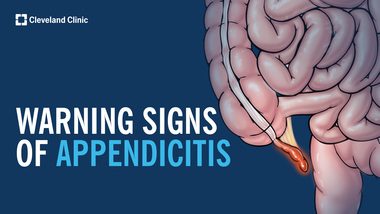 How Can Your Appendix Burst