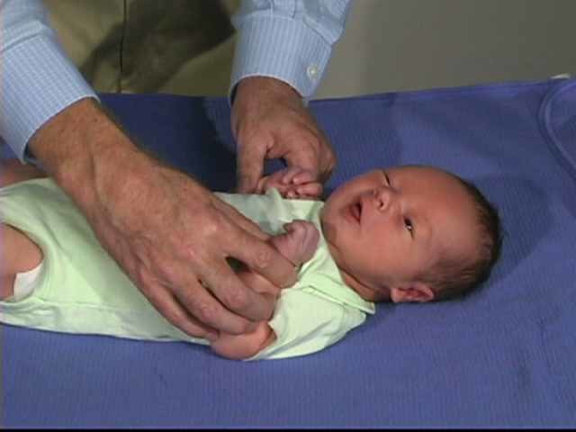 Neurologic Exam-Pediatric | Newborn | Normal | Tone - Arm Recoil