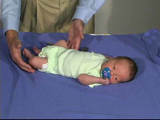 Neurologic Exam-Pediatric | Newborn | Normal | Tone - Resting Posture