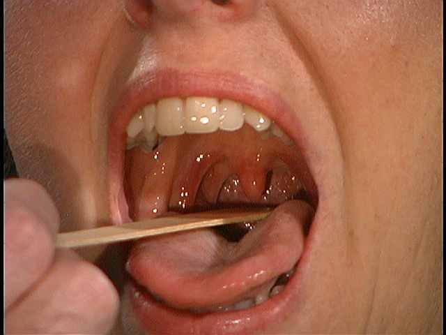 gag reflex method