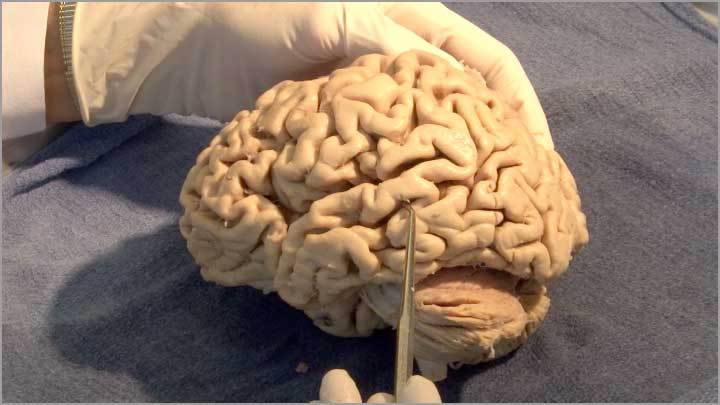 what is human dissection