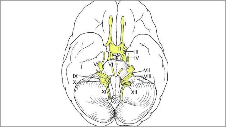 Brain Dissection 08 - Cranial Nerves