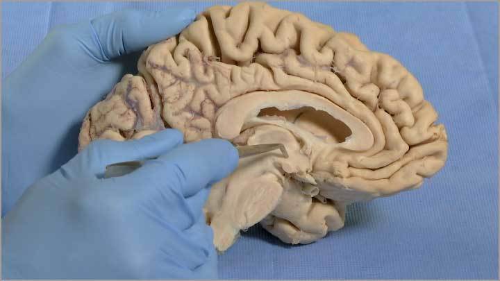 Brain Dissection 24 - Hypothalamus