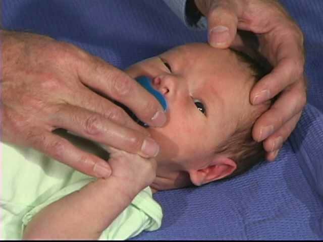 Neurologic Exam-Pediatric | Newborn | Normal | Cranial Nerves