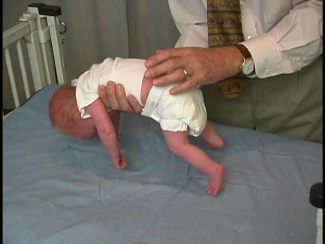 Neurologic Exam-Pediatric | Newborn | Abnormal | Positions - Ventral ...