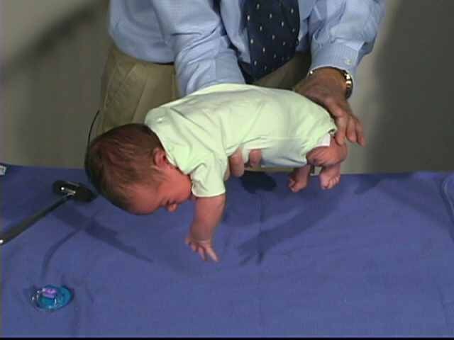 Neurologic Exam-Pediatric | Newborn | Normal | Positions - Ventral ...