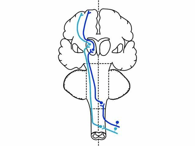 how to draw human in neuro exam