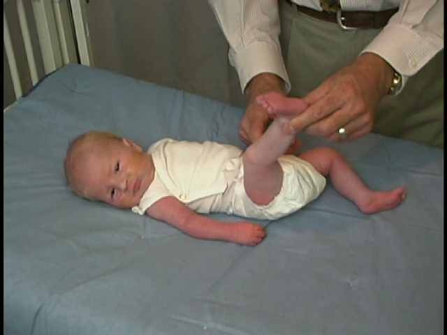 Neurologic Exam-Pediatric | Newborn | Abnormal | Tone - Leg Traction