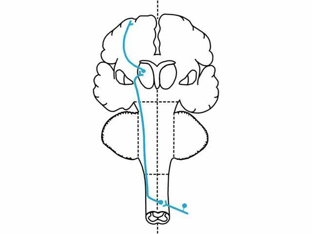 spinothalamic pathway drawing