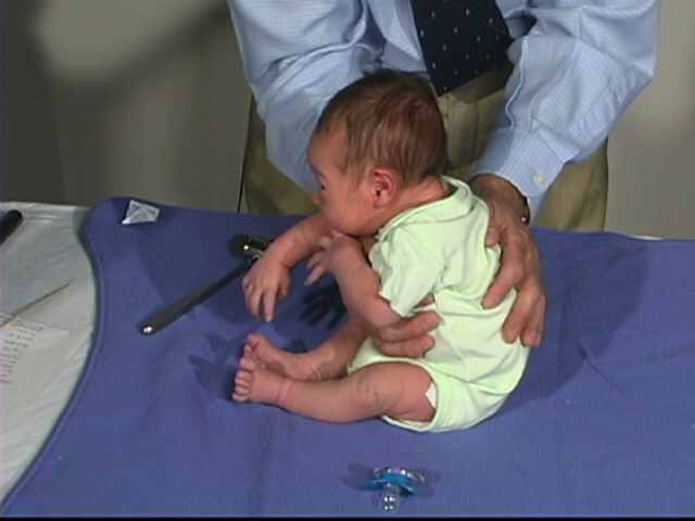 Neurologic Exam-Pediatric | Newborn | Normal | Tone Head Lag