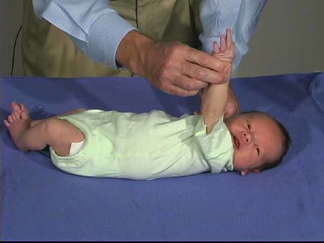 Neurologic Exam-Pediatric | Newborn | Normal | Tone - Arm Traction