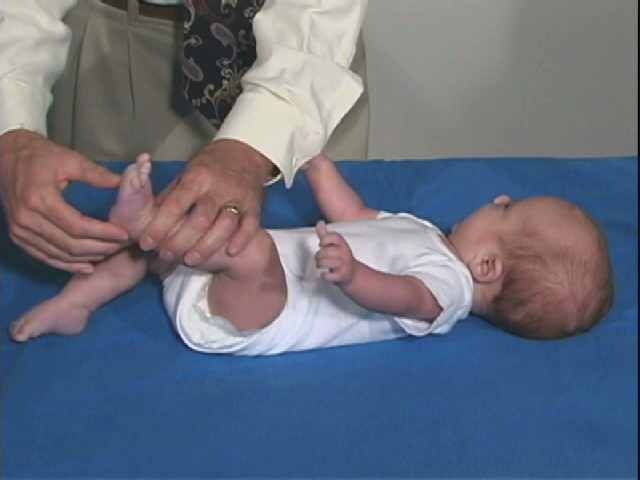 plantar reflex normal