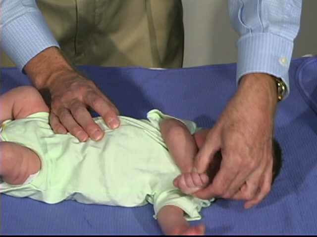 Neurologic Exam-Pediatric | Newborn | Normal | Tone - Scarf Sign