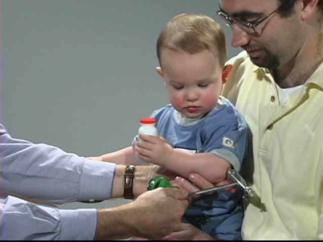 Neurologic Exam-Pediatric | 18-month-old | Normal | Motor/Reflexes ...