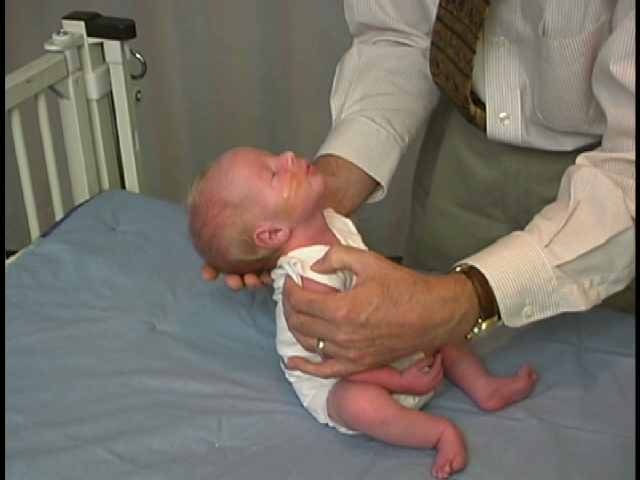 traction reflex normal