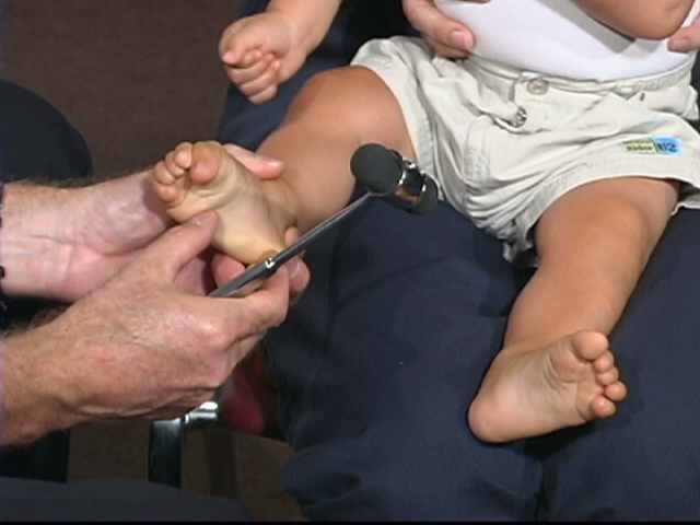 positive supporting reflex